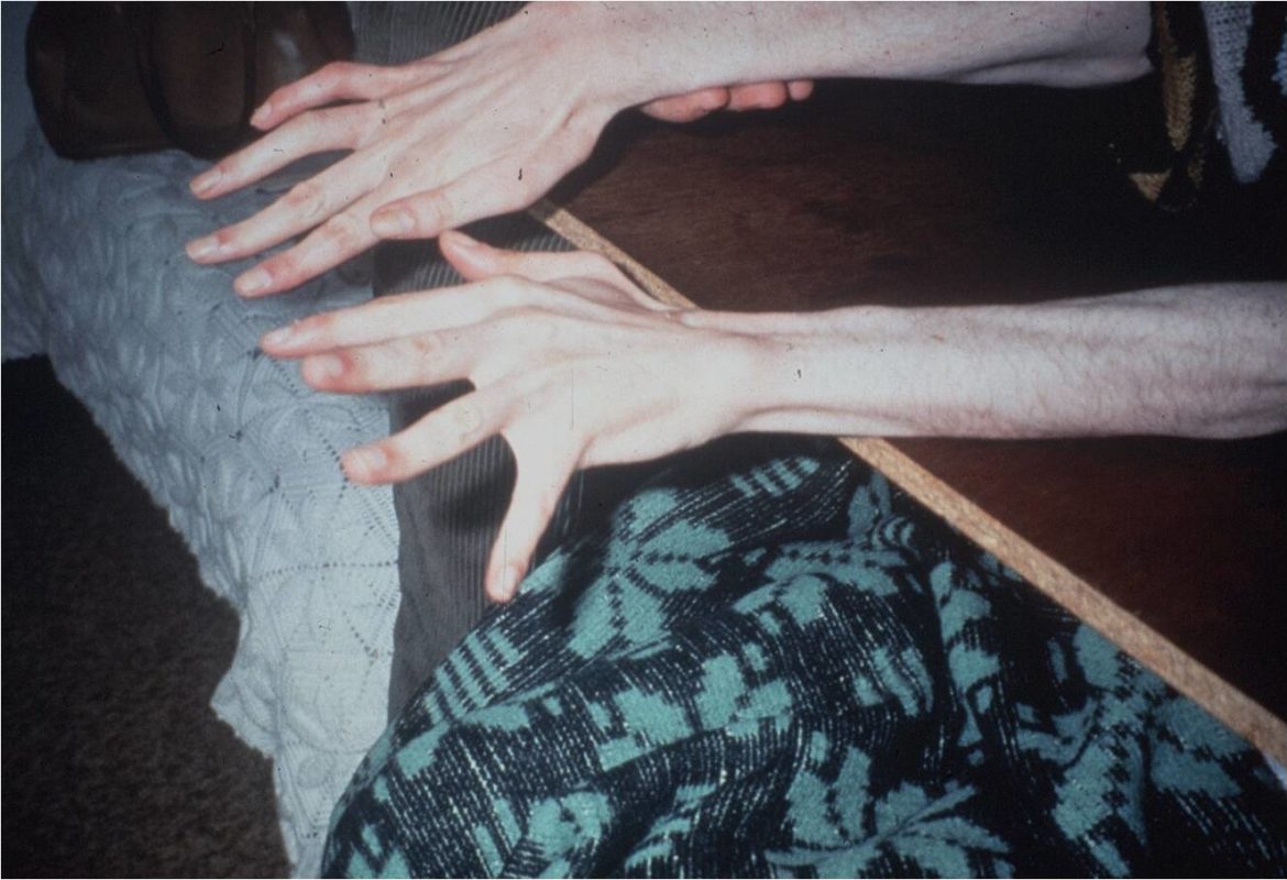 Neurological news from Portugal IV - Machado-Joseph Disease: from past ...